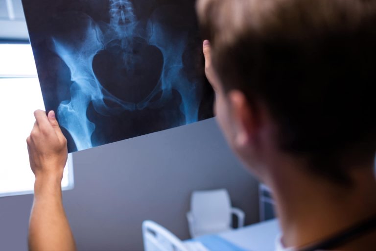 Pubalgia u Osteopatía Dinámica de Pubis (ODP) | Manuel Cuenca